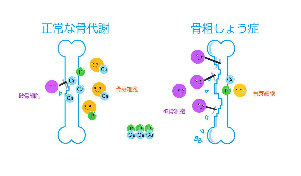【必読】肌断食の日焼け止めの選び方｜肌にやさしい紫外線対策とは
